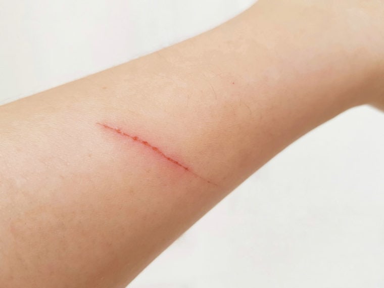 Why Are Cat Scratches Itchy? 4 Vet-Explained Reasons | Hepper